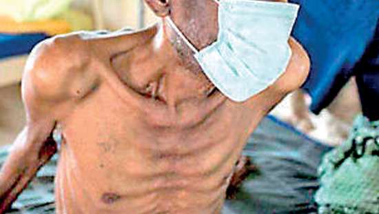 Time to dispel some myths about the disease - Medicine | Daily Mirror